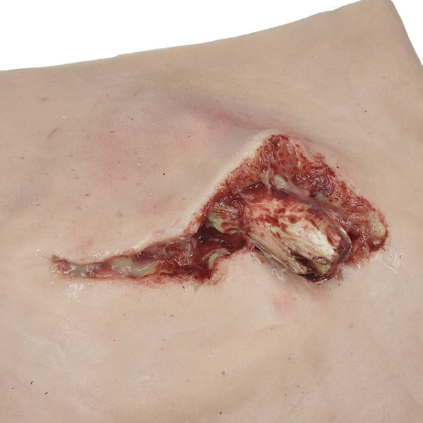 Protruding Femur Fracture – GTSimulators.com