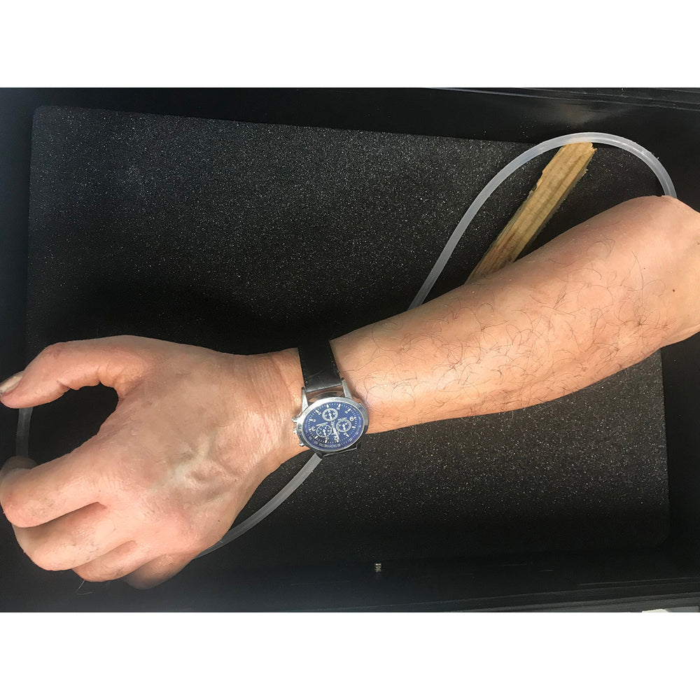 Realistic Trauma Training Lower Arm with Foreign Object for Hemorrhage ...