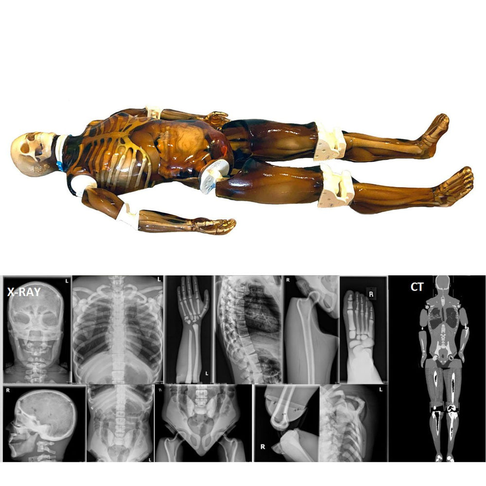 Adult Full Human Body Phantom (with Muscles) for X-Ray, CT Scan and Ul ...