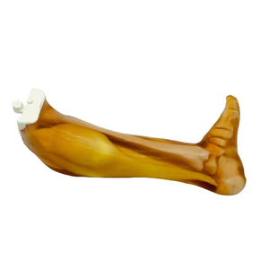 X-Ray Phantoms | Radiology Training Phantoms and Simulators ...