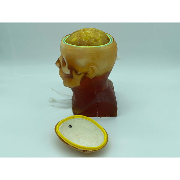 Advanced Adult Head Phantom for X-Ray CT, Ultrasound and MRI ...