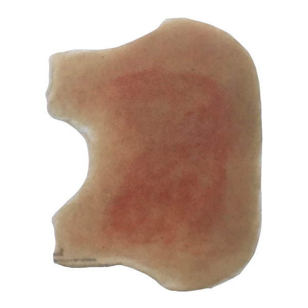 Anaphylactic Rash – GTSimulators.com