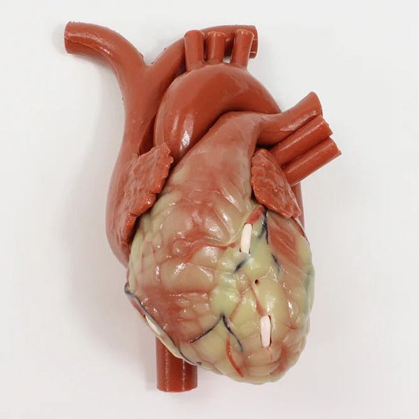CABG Heart Patent Non-Beating – GTSimulators.com