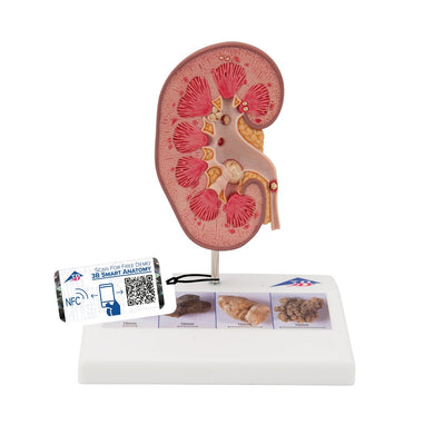 Anatomy Pathology Models – Tagged "Kidney Models" – GTSimulators.com