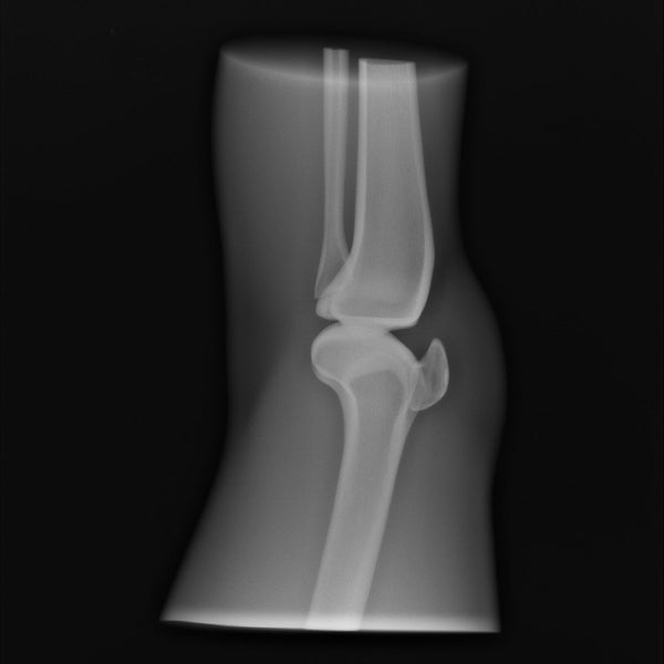 Knee Phantom, With 90° Flexion – GTSimulators.com