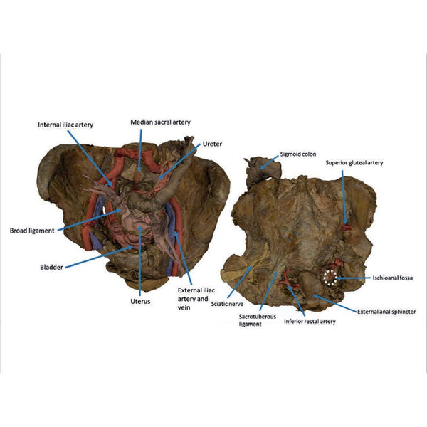 Ischiorectal Fossa 3d