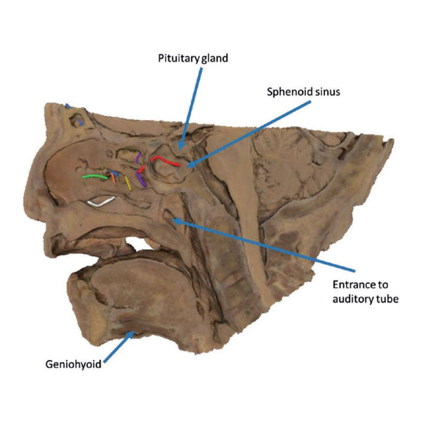 3D Printed Sinus Pathways – GTSimulators.com