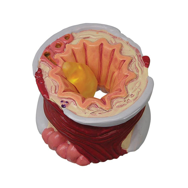 Cross-section Bronchus Model | 4-Set cross-section Bronchus Model ...