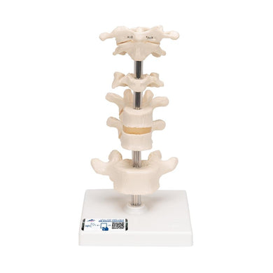Thoracic Spinal Column Models | Osteoporosis Models – Tagged "Vertebrae ...