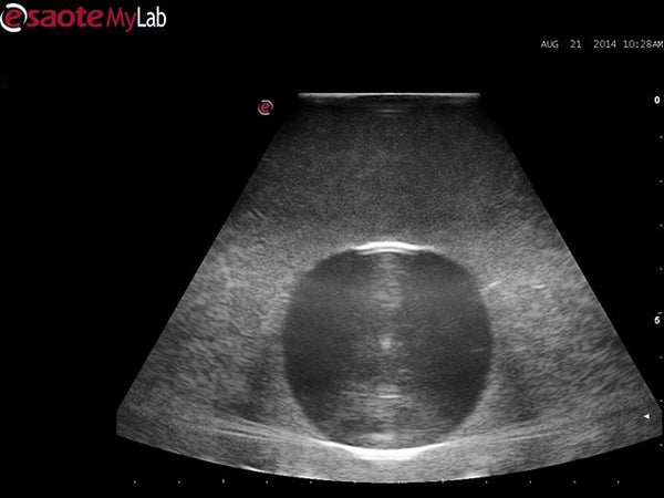 Abscess Drainage Ultrasound Training Model – GTSimulators.com