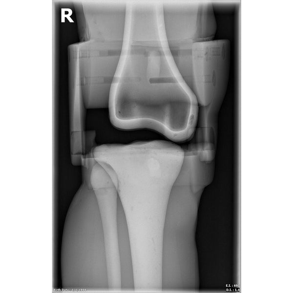 Adult Full Human Body Phantom(With Muscles) for X-Ray CT & MRI Trainin ...