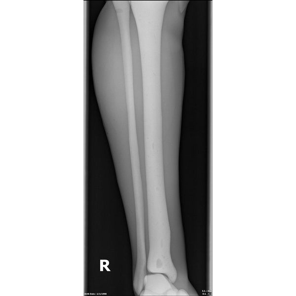 Adult Full Human Body Phantom(With Muscles) for X-Ray CT & MRI Trainin ...