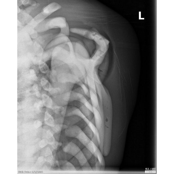 Adult Full Human Body Phantom(With Muscles) for X-Ray CT & MRI Trainin ...