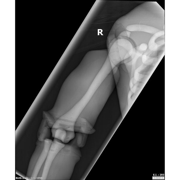 Adult Full Human Body Phantom(With Muscles) for X-Ray CT & MRI Trainin ...