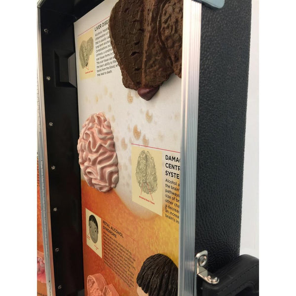 Alcohol Abuse Consequences 3D Display – GTSimulators.com