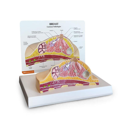 BSE Models | Breast Cancer Models | Breast Models – GTSimulators.com
