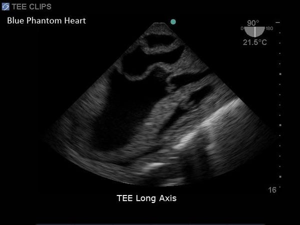 Cardiac Echo Ultrasound Training Model | CAE Blue Phantom ...