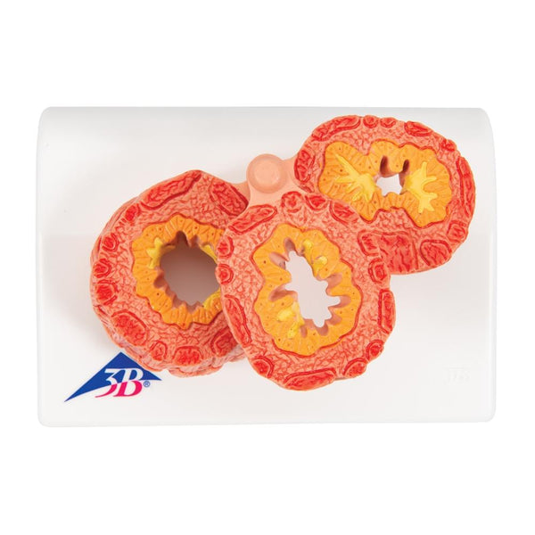 COPD Model, Chronic Lung Disease – GTSimulators.com