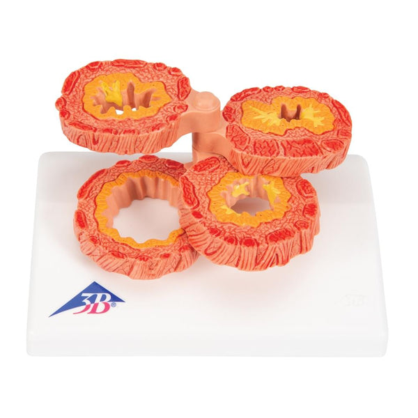 COPD Model, Chronic Lung Disease – GTSimulators.com