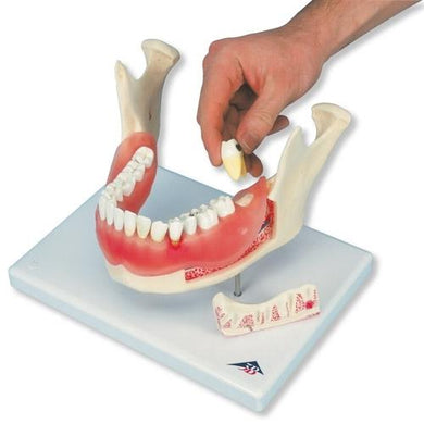 Dental Models | Teeth and Jaw Models | Anatomy Models – GTSimulators.com