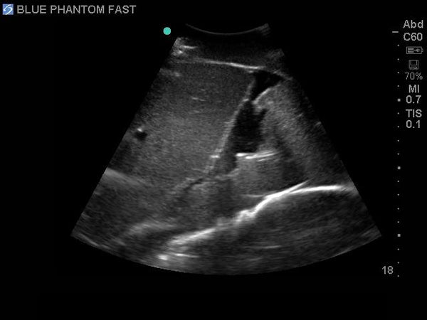 FAST Exam Real Time Ultrasound Training Model, Transthoracic Only ...