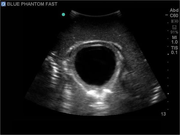 FAST Exam Real Time Ultrasound Training Model, Transthoracic Only ...