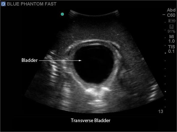 FAST Exam Real Time Ultrasound Training Model, Transthoracic Only ...