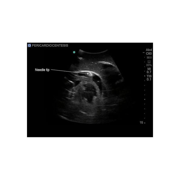 FAST Exam Ultrasound Training Model, Transthoracic and Transesophageal ...