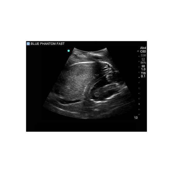 FAST Exam Ultrasound Training Model, Transthoracic and Transesophageal ...