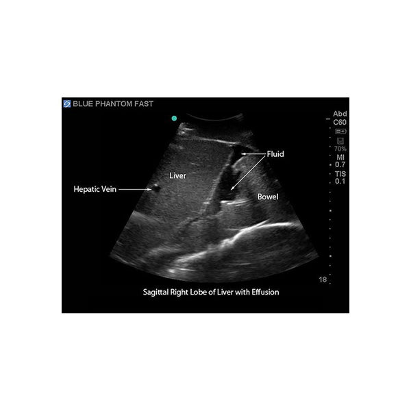 FAST Exam Ultrasound Training Model, Transthoracic and Transesophageal ...