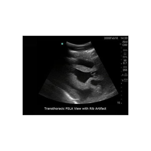 FAST Exam Ultrasound Training Model, Transthoracic and Transesophageal ...