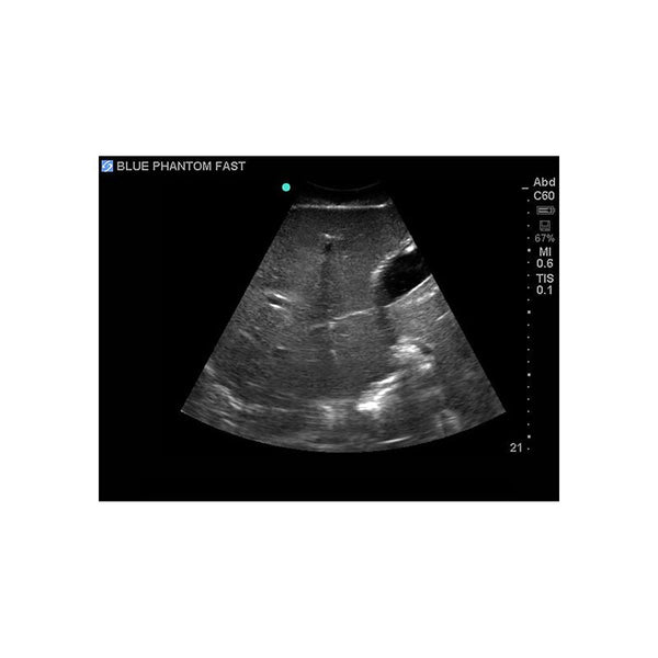 FAST Exam Ultrasound Training Model, Transthoracic and Transesophageal ...