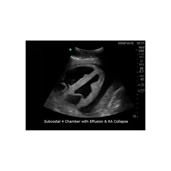 FAST Exam Ultrasound Training Model, Transthoracic and Transesophageal ...