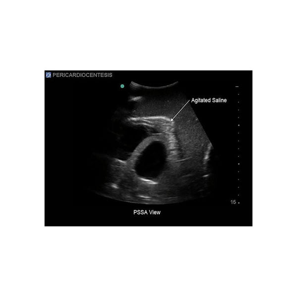 FAST Exam Ultrasound Training Model, Transthoracic and Transesophageal ...