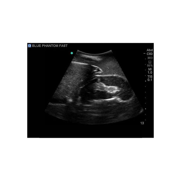 FAST Exam Ultrasound Training Model, Transthoracic and Transesophageal ...