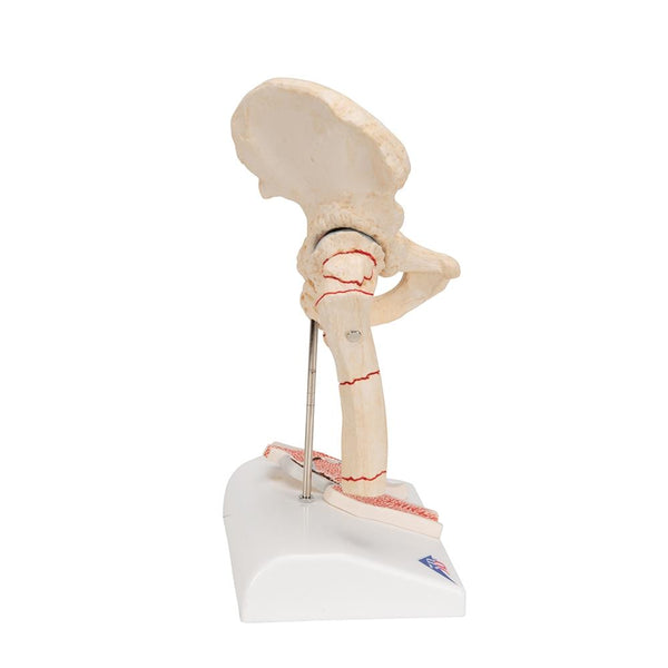 Femoral Fracture and Hip Osteoarthritis Model – GTSimulators.com