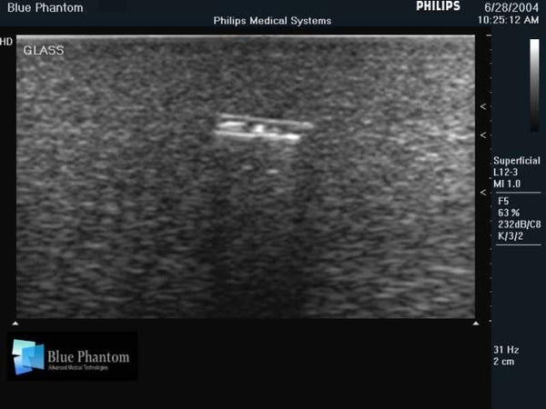Foreign Body Identification Ultrasound Training – GTSimulators.com