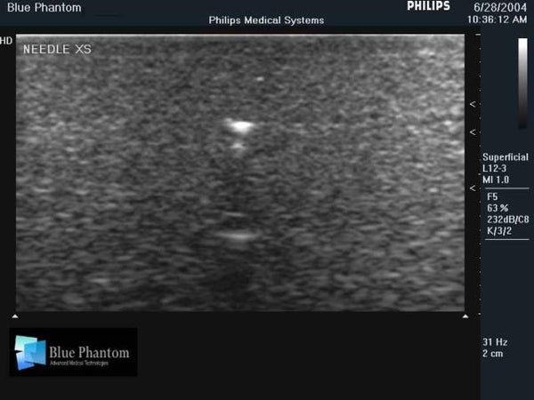 Foreign Body Identification Ultrasound Training – GTSimulators.com