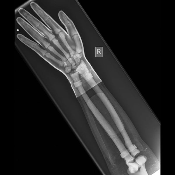 Full Body X-Ray and Radiographic Positioning Manikin – GTSimulators.com