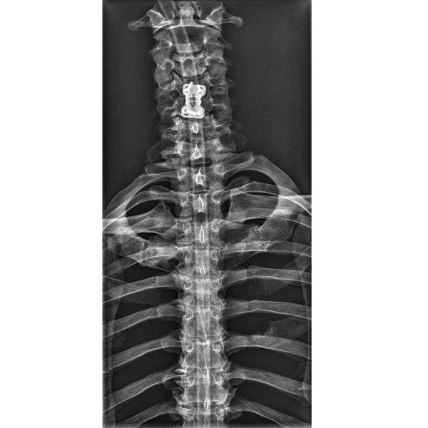 Full Body X-Ray Phantom with Real Human Skeleton Bones – GTSimulators.com