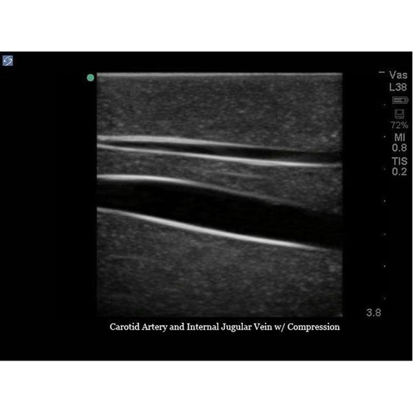 Gen II Ultrasound Central Line Training Model | CAE Blue Phantom ...