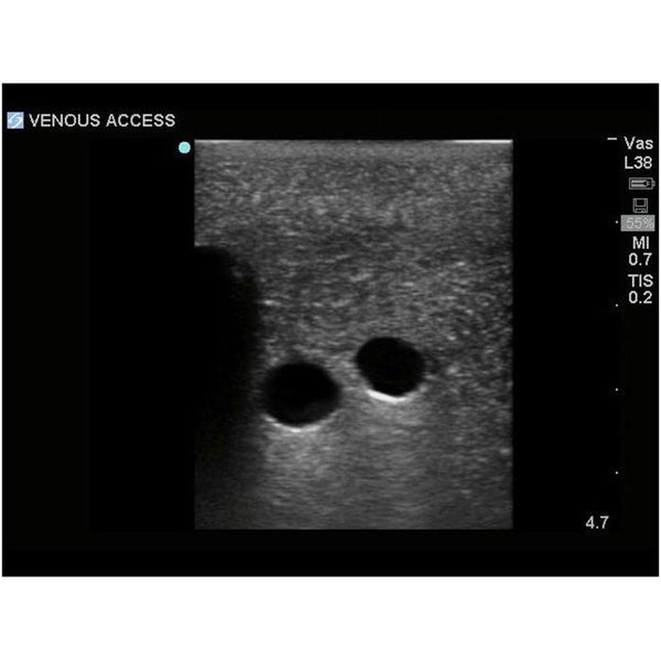 Gen II Ultrasound Central Line Training Model | CAE Blue Phantom ...