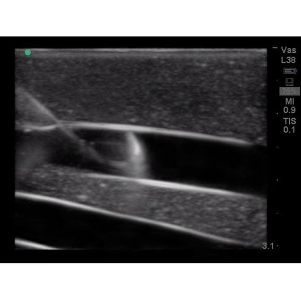 Gen II Ultrasound Central Line Training Model | CAE Blue Phantom ...