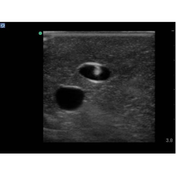 Gen II Ultrasound Central Line Training Model | CAE Blue Phantom ...