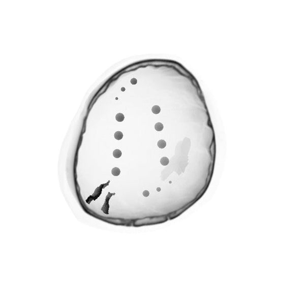 Stroke / Bleed Head Phantom for CT Scan and X-Ray Training ...