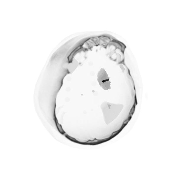 Stroke / Bleed Head Phantom for CT Scan and X-Ray Training ...