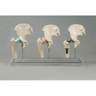 Human Joint Models | Elbow, Hip, Knee and Shoulder Joint Models ...