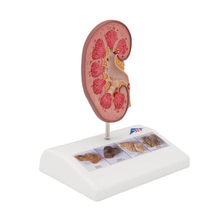 Anatomy Pathology Models – Tagged "Kidney Models" – GTSimulators.com