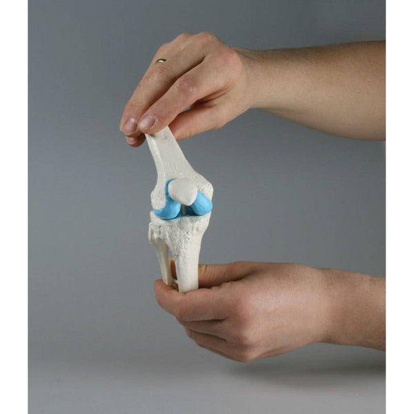 Knee Implant Model – GTSimulators.com