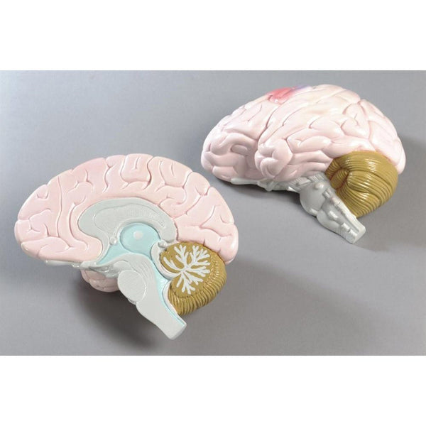 Midsagittal Plane Brain